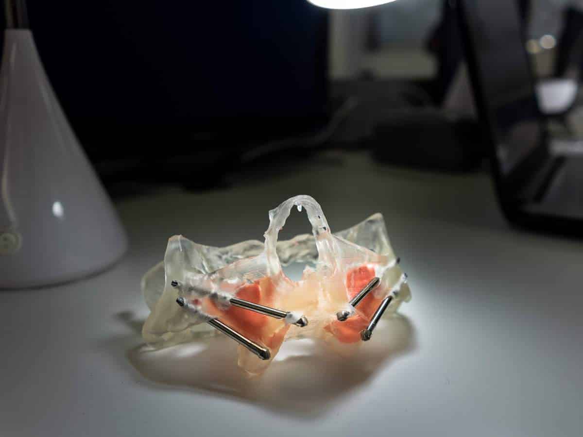 ZAGA or Original Technique for Zygomatic Implants