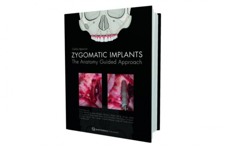 Study the Science behind ZAGA Concept for Zygomatic Implants