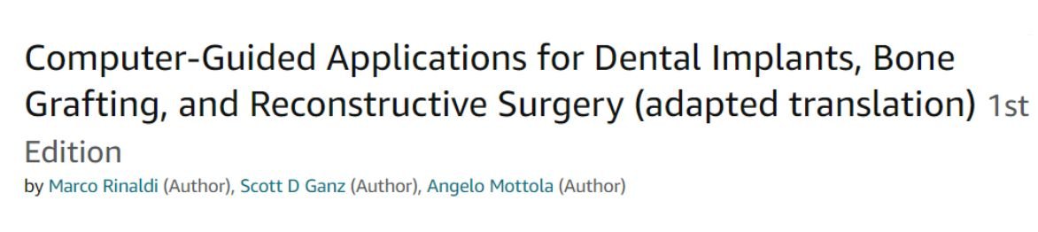 Study the Science behind ZAGA Concept for Zygomatic Implants