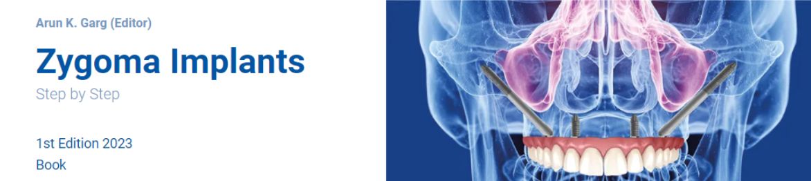 Study the Science behind ZAGA Concept for Zygomatic Implants