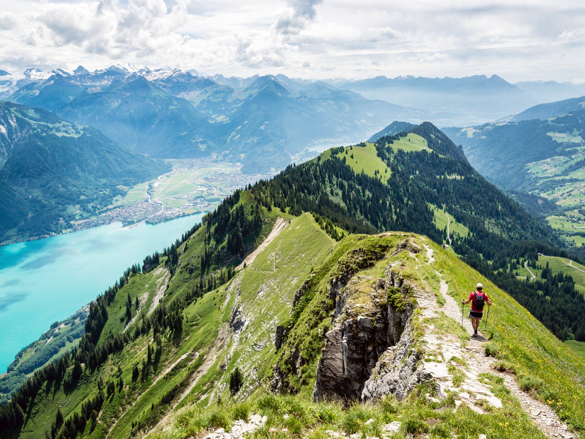 The ZAGA Straumann Zygomatic Implants Explained